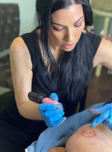 The Artistry of Concealment: Transforming Stretch Marks with Permanent ...